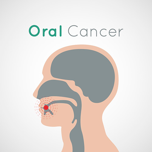 15 Questions and Answers About Oral Cancer and How Dentists Can Help