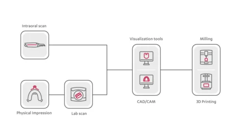 Step-By-Step Guide To A Dental 3D Workflow | Benco Dental