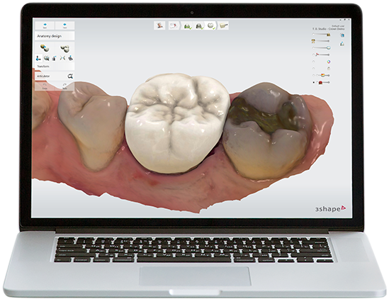 Dental Design Software | Benco Dental